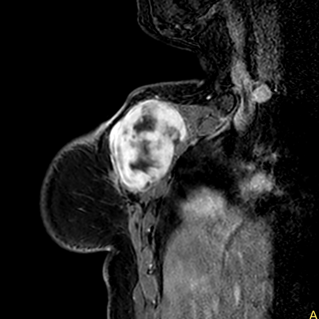 Digital MRI Department - Synergy Imaging