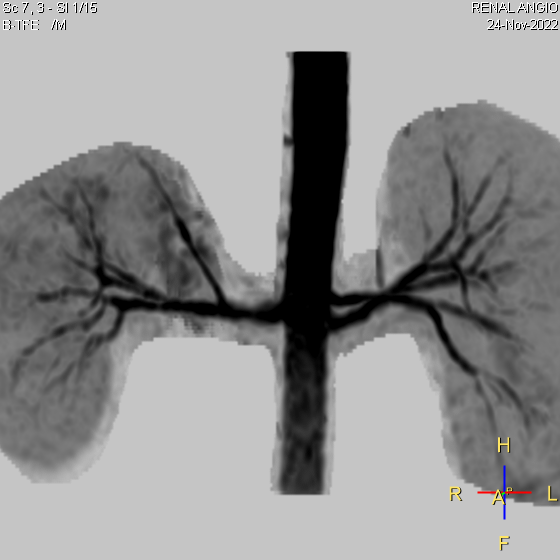 Digital MRI Department - Synergy Imaging