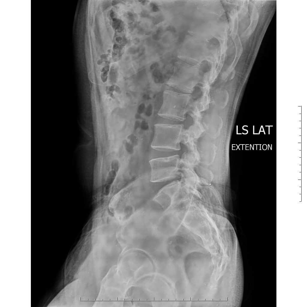 Digital X Ray Deparrment - Synergy Imaging