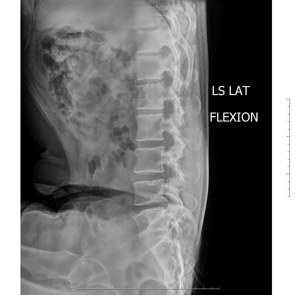 Digital X Ray Deparrment - Synergy Imaging