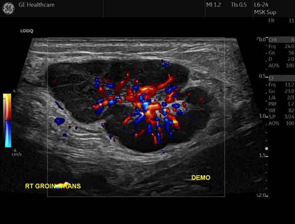 Ultrasound - Synergy Imaging
