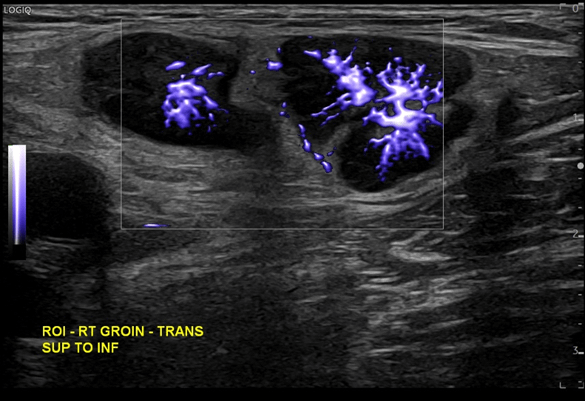 Ultrasound - Synergy Imaging